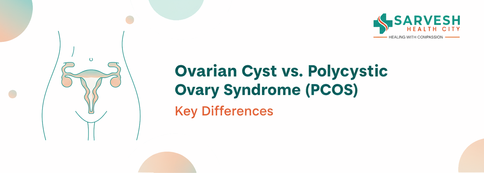 Ovarian Cyst vs. Polycystic Ovary Syndrome (PCOS): Key Differences